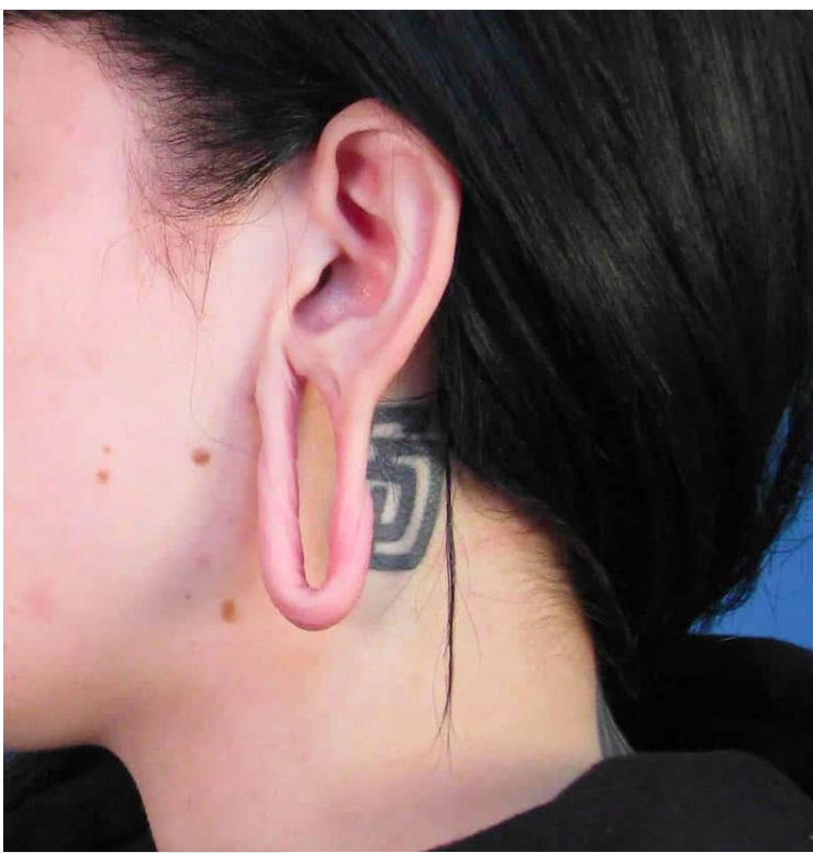 Nong tai, thú chơi 'kinh dị' của giới trẻ