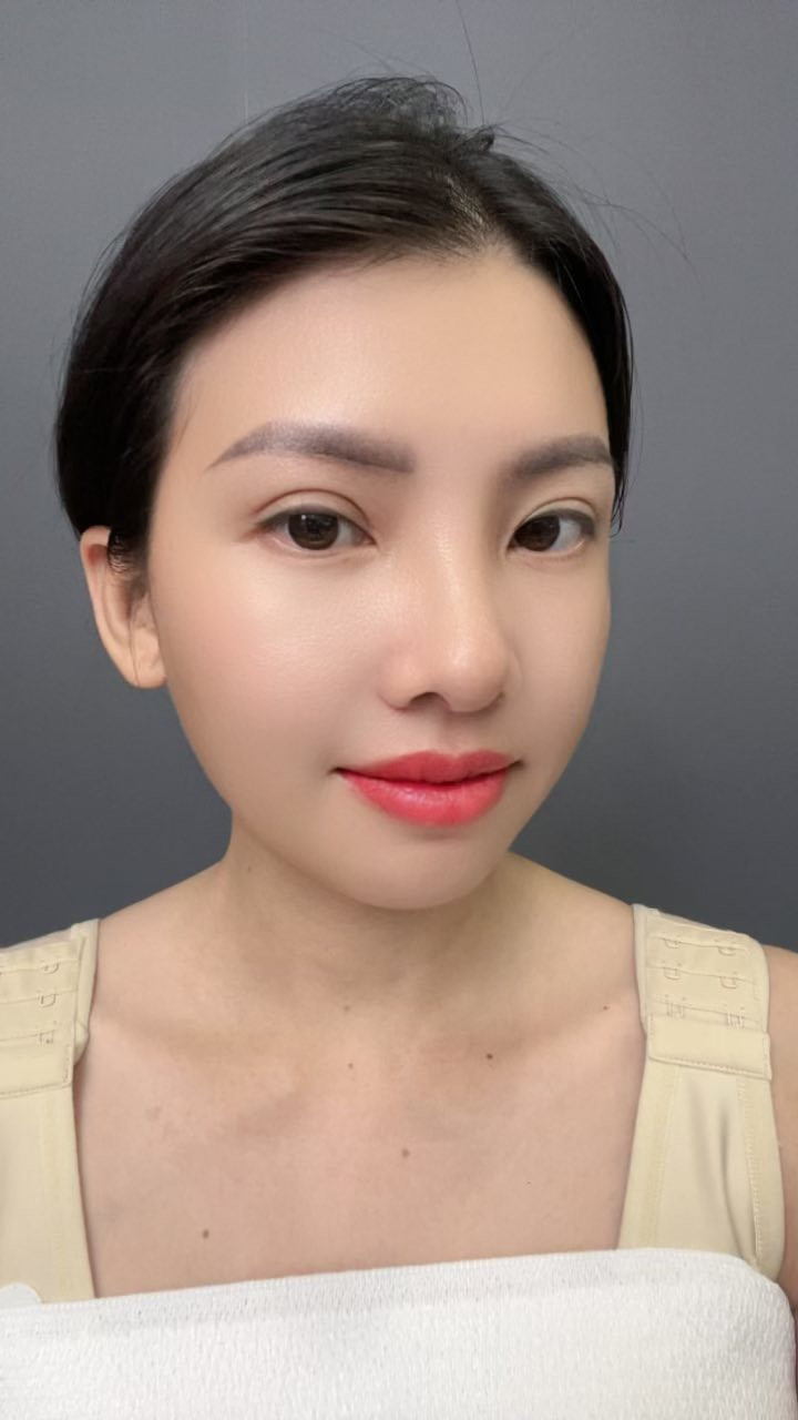 Thị Nở tái sinh Quách Phượng tiếp tục thẩm mỹ, diện mạo mới gây bất ngờ